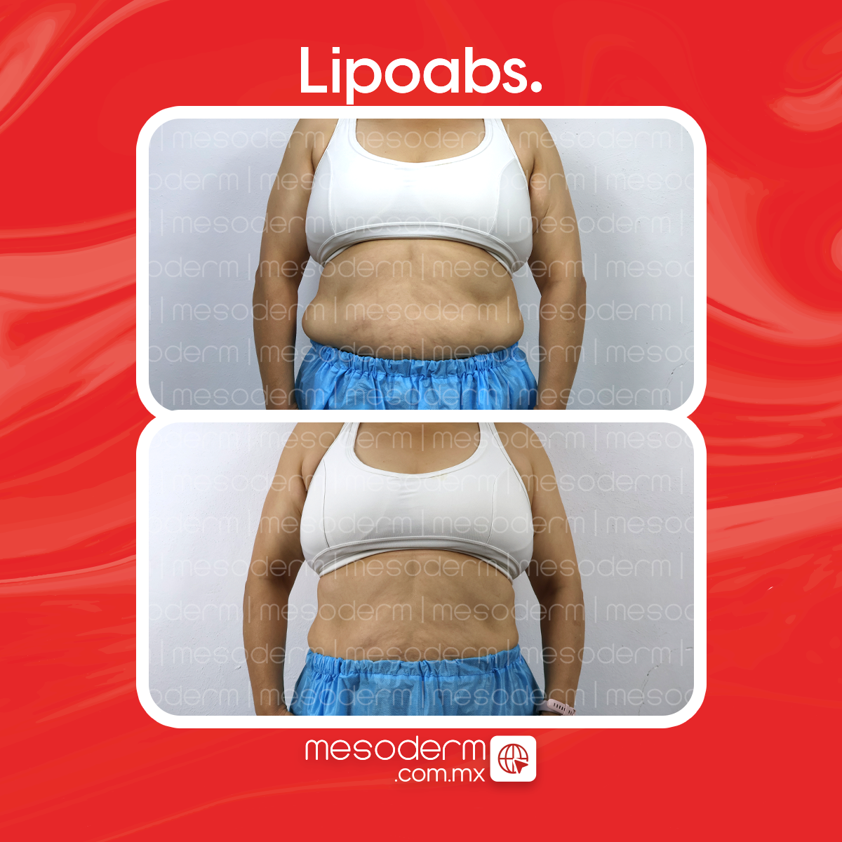 Resultados Mesoderm